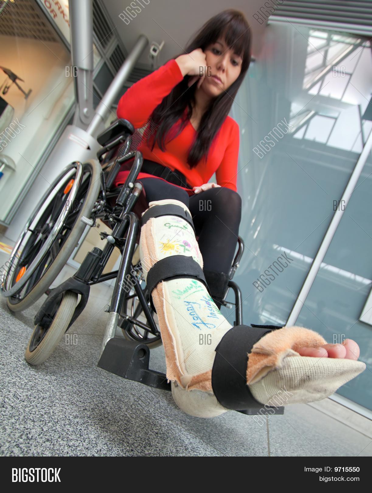 Woman Leg Cast Image & Photo (Free Trial) | Bigstock