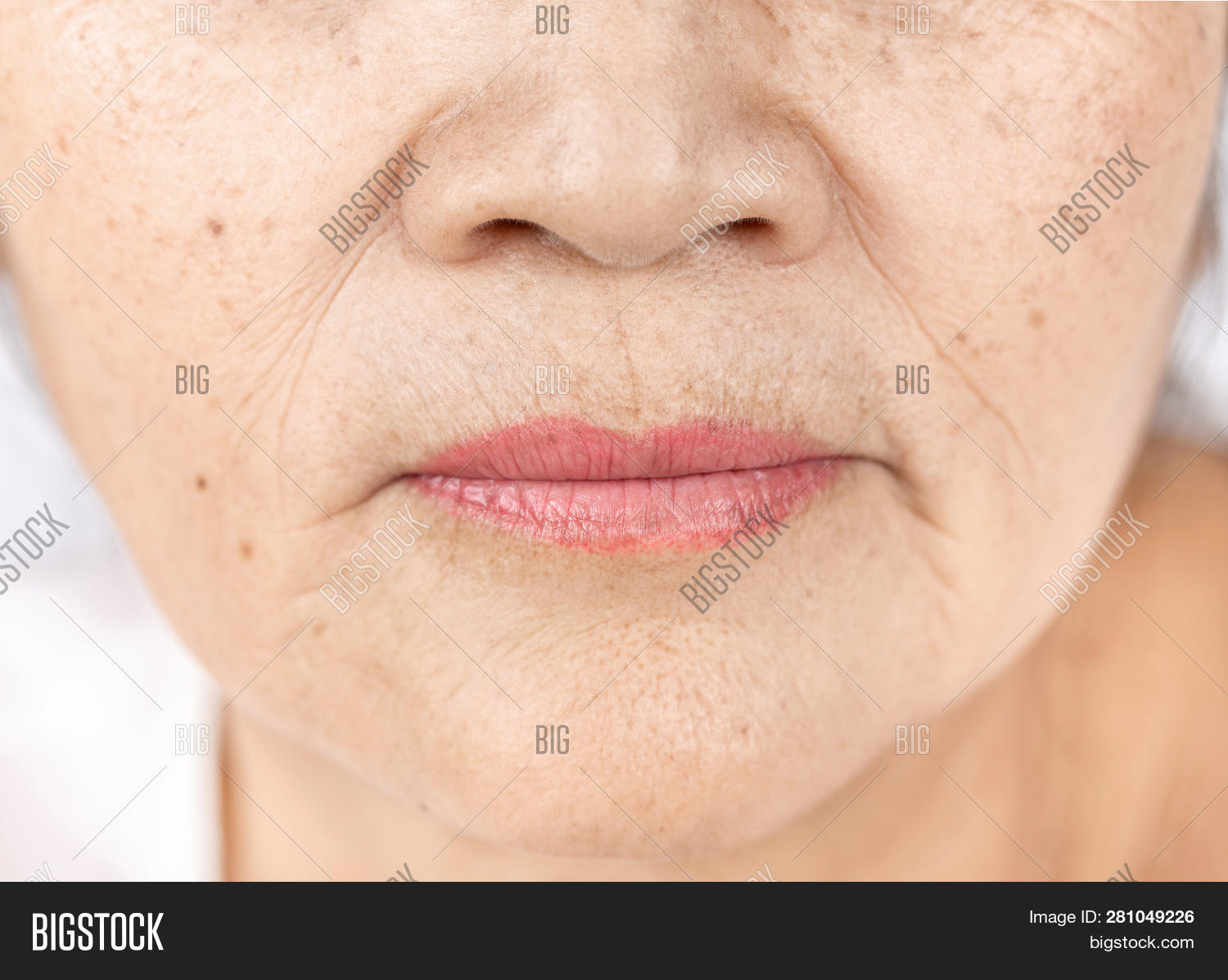 Wrinkle Freckles Skin Image & Photo (Free Trial) | Bigstock