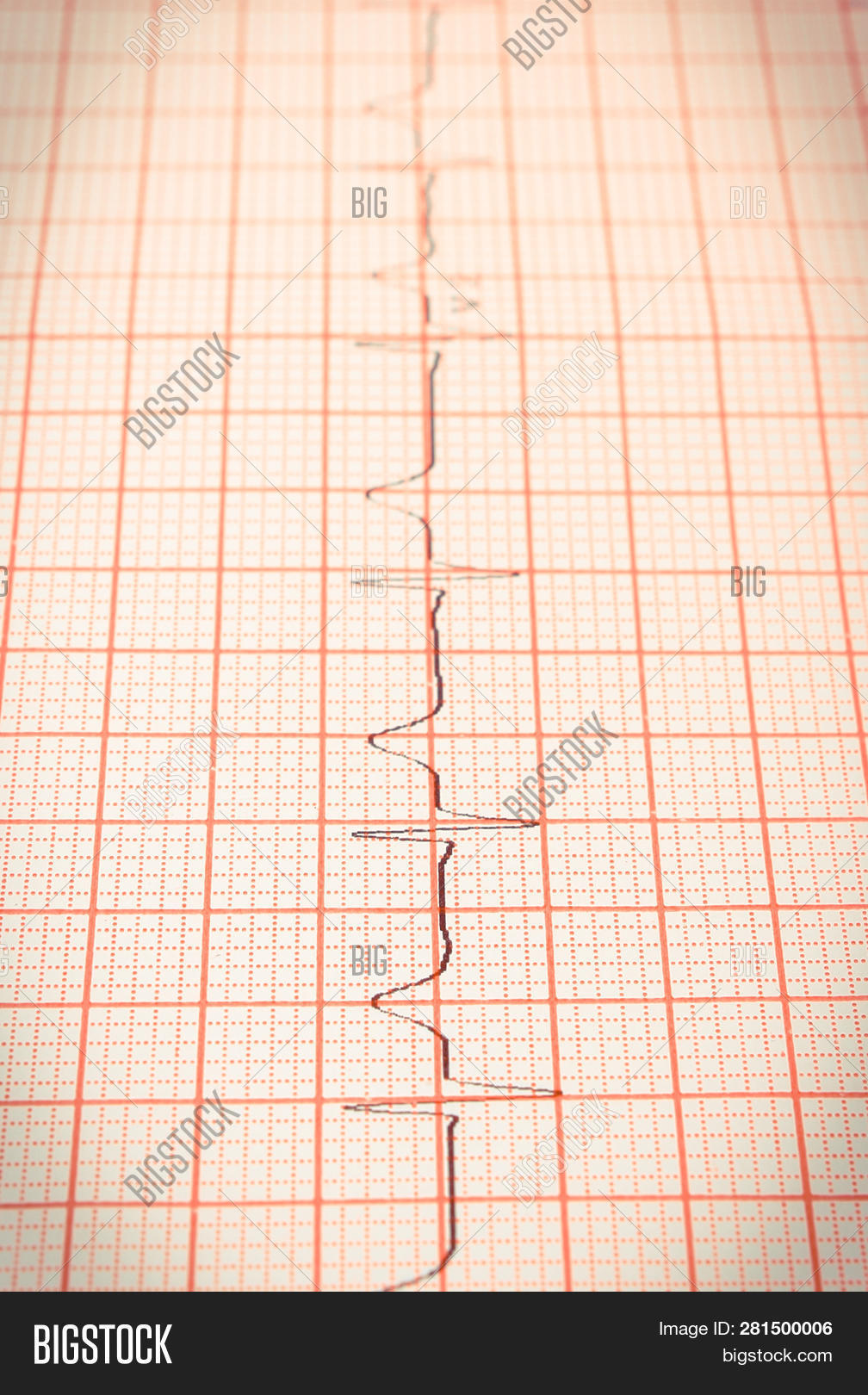 Electrocardiogram Image & Photo (Free Trial) | Bigstock