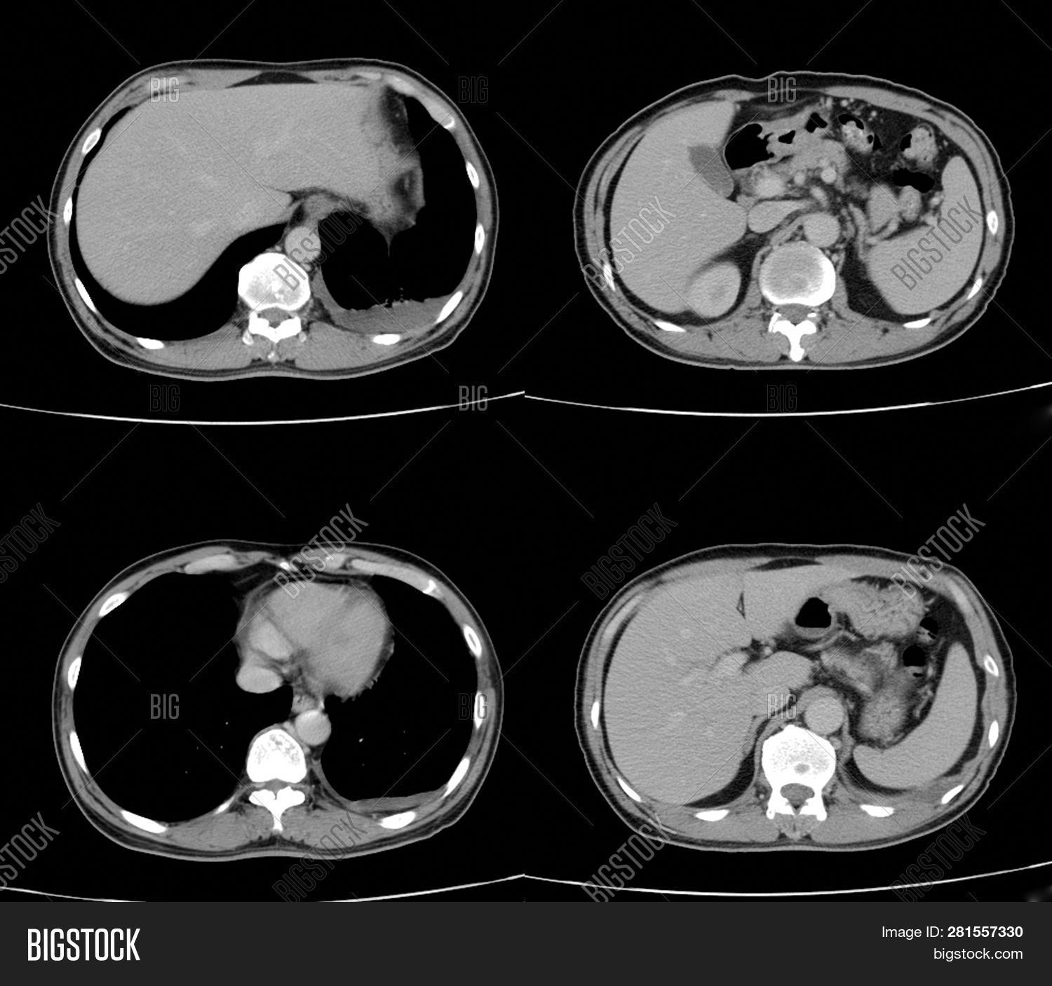 Transverse View Axial Image & Photo (Free Trial) | Bigstock