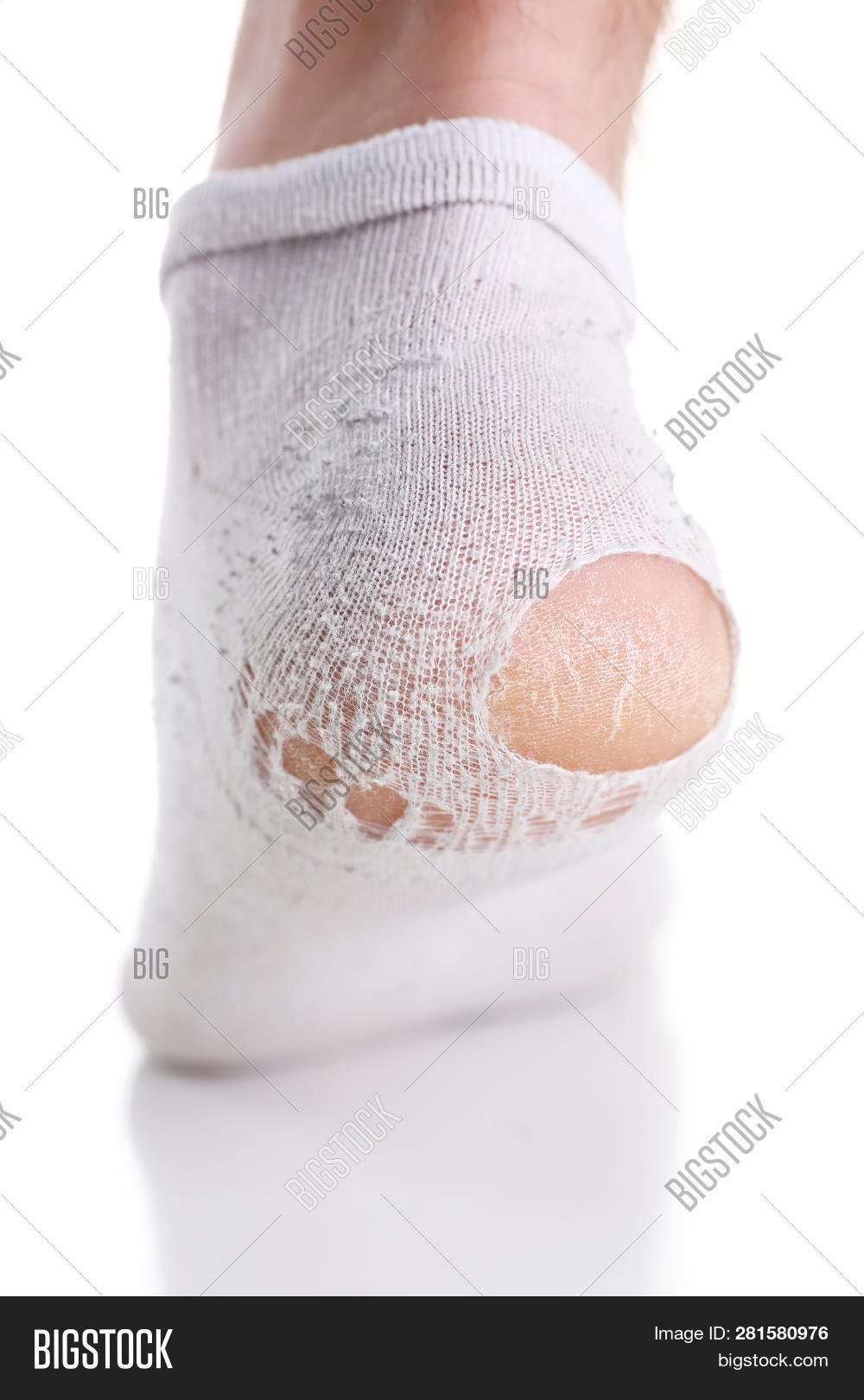 Ripped White Sock On Image & Photo (Free Trial) | Bigstock