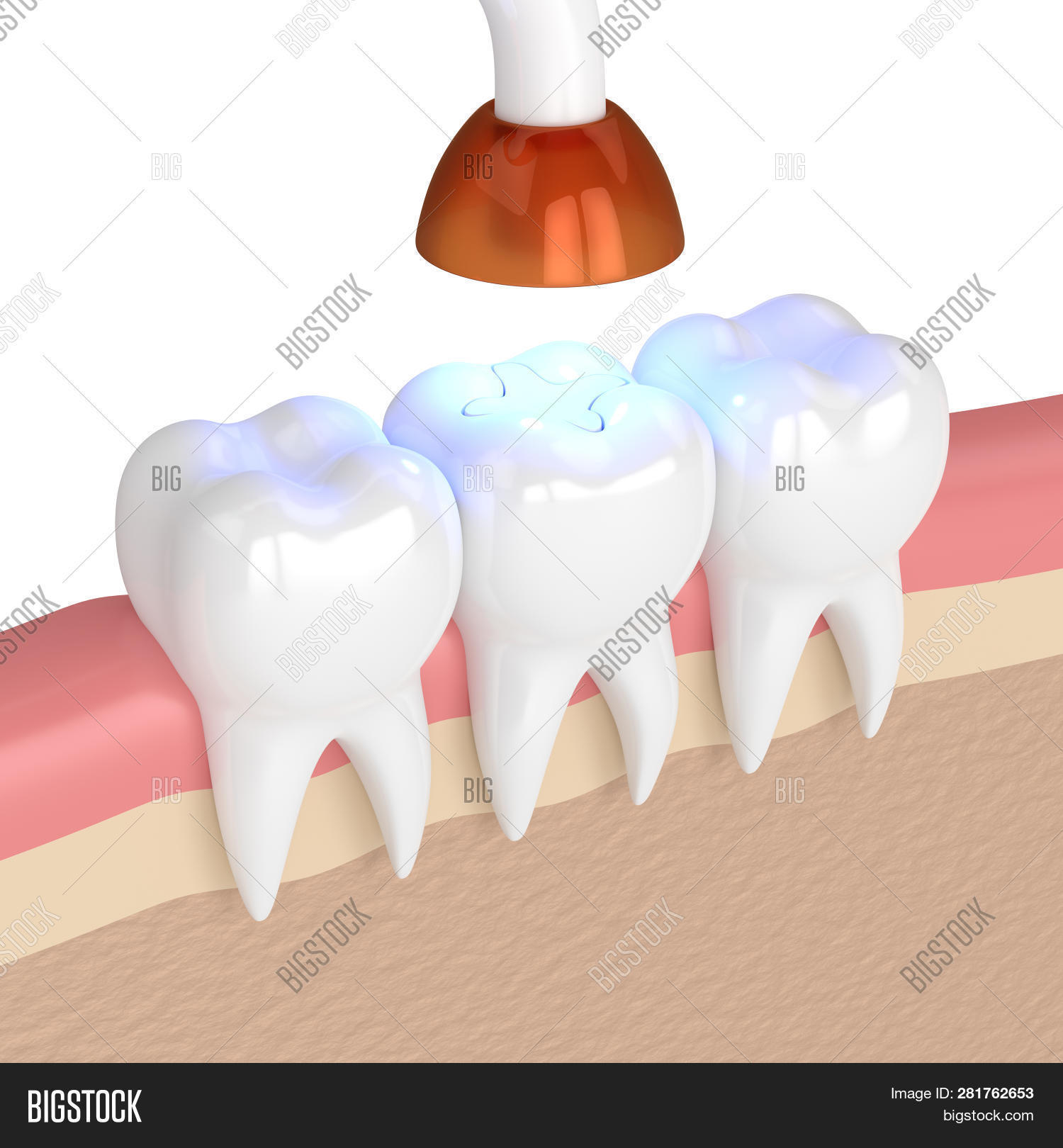 3d Render Teeth Dental Image & Photo (Free Trial) | Bigstock