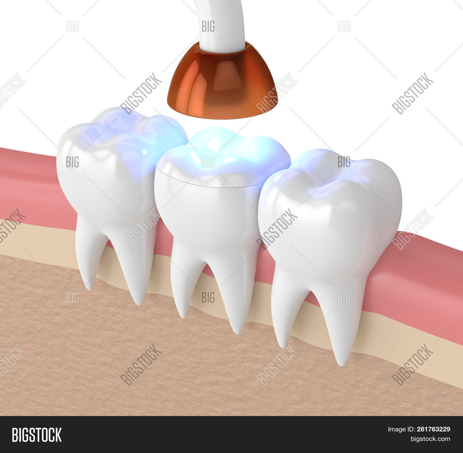 3d Render Teeth Dental Image & Photo (Free Trial) | Bigstock