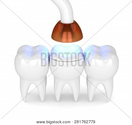 3D Render Teeth Dental Image & Photo (Free Trial) | Bigstock
