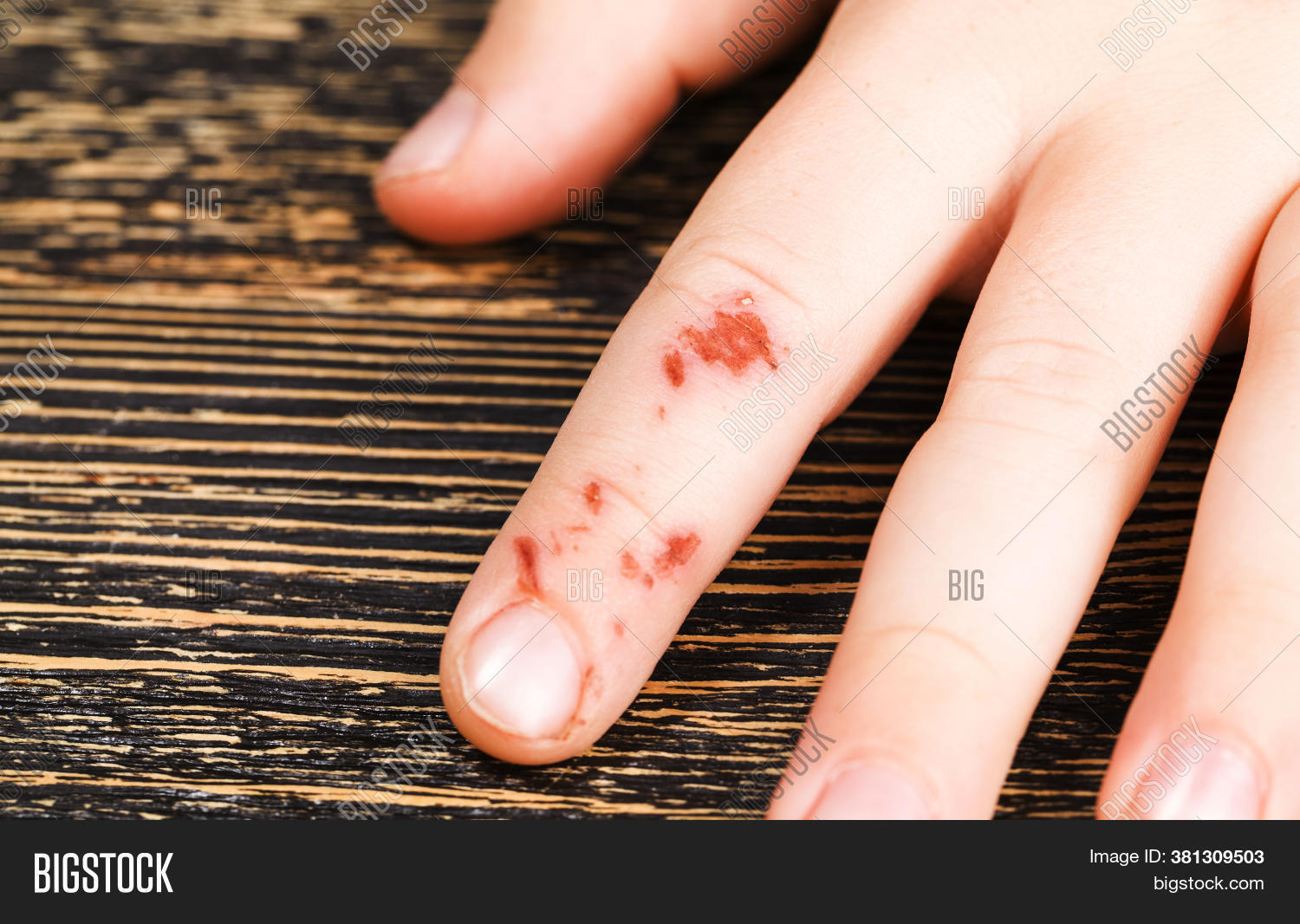 Finger On Childs Hand Image & Photo (Free Trial) | Bigstock