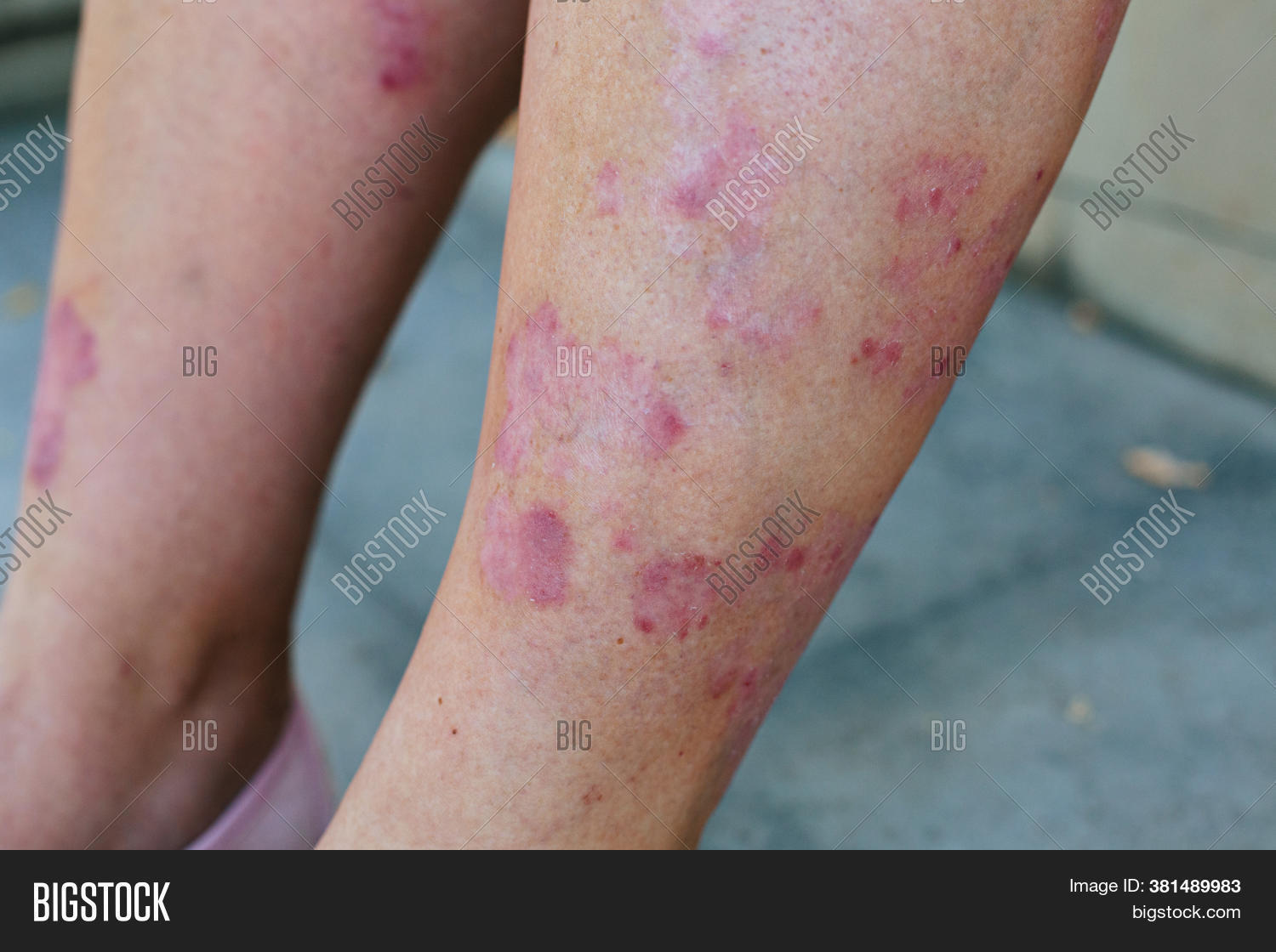 Closeup Legs Woman Image & Photo (Free Trial) | Bigstock