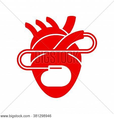 Pacemaker Vector & Photo (Free Trial) | Bigstock