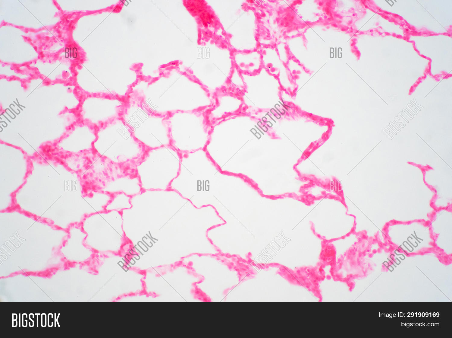 Human Lung Tissue Image & Photo (Free Trial) | Bigstock
