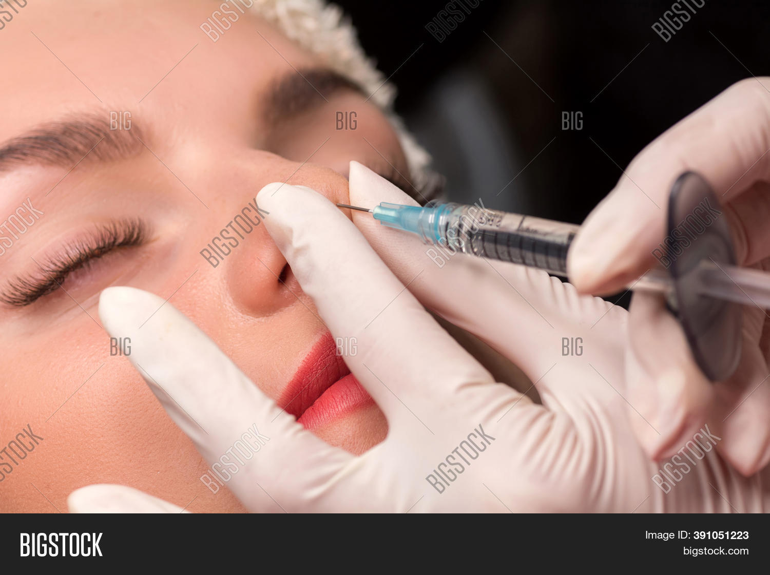 Injection Rhinoplasty Image & Photo (Free Trial) | Bigstock