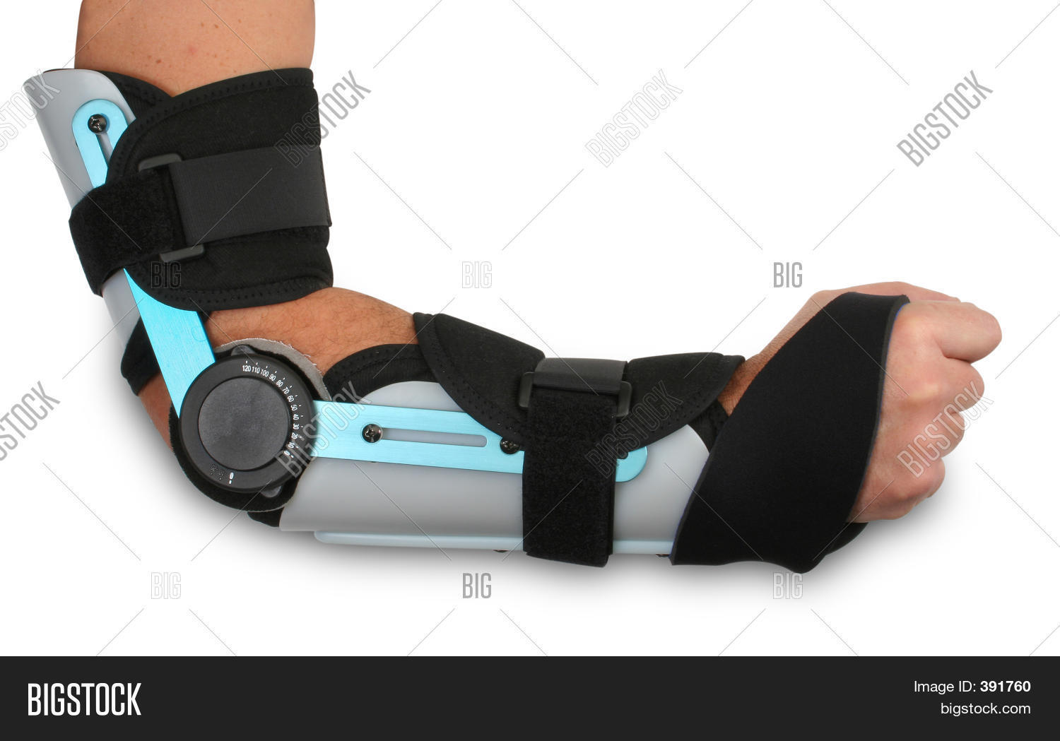 Broken Arm Cast Image & Photo (Free Trial) | Bigstock