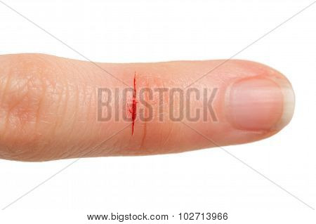 Cut Finger Blood Image & Photo (Free Trial) | Bigstock