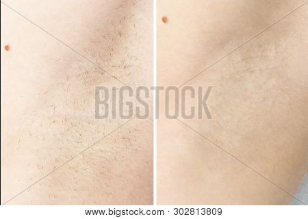 Waxing Cosmetic Image & Photo (Free Trial) | Bigstock