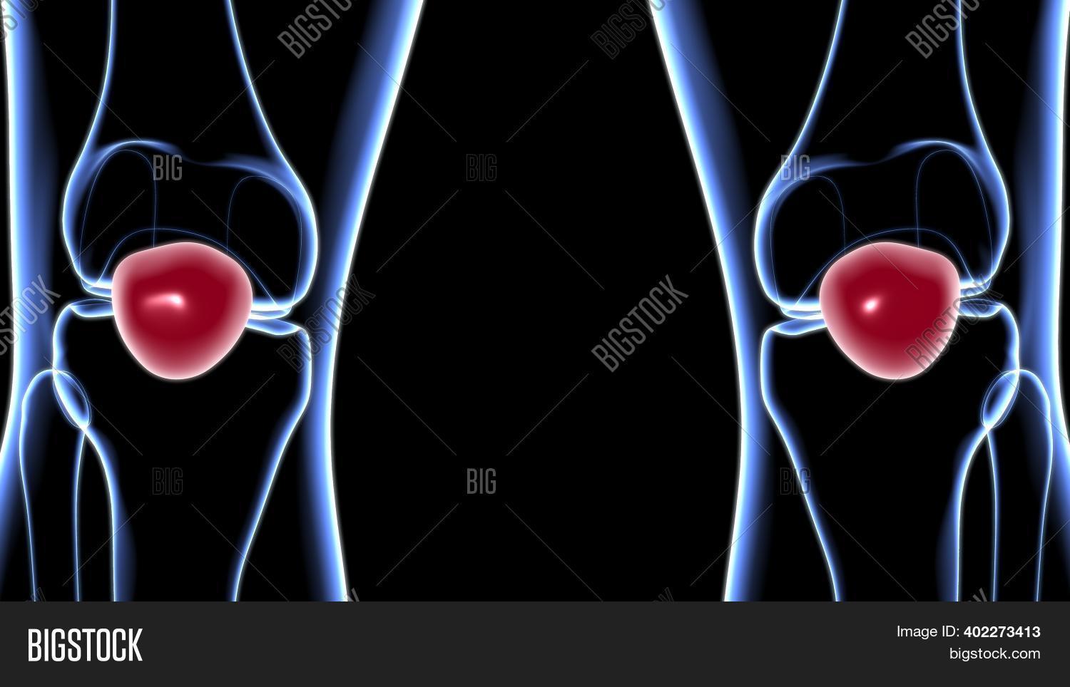 Human Skeleton Anatomy Image & Photo (Free Trial) | Bigstock