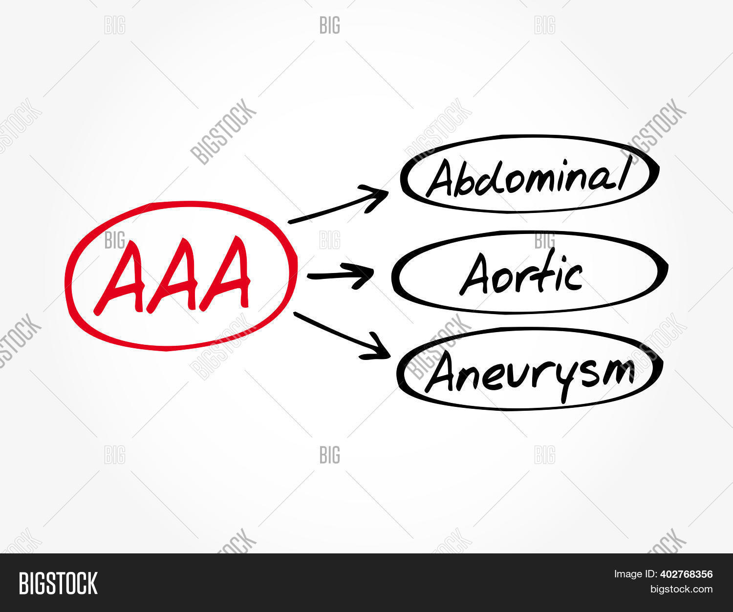 Aaa - Abdominal Aortic Image & Photo (Free Trial) | Bigstock
