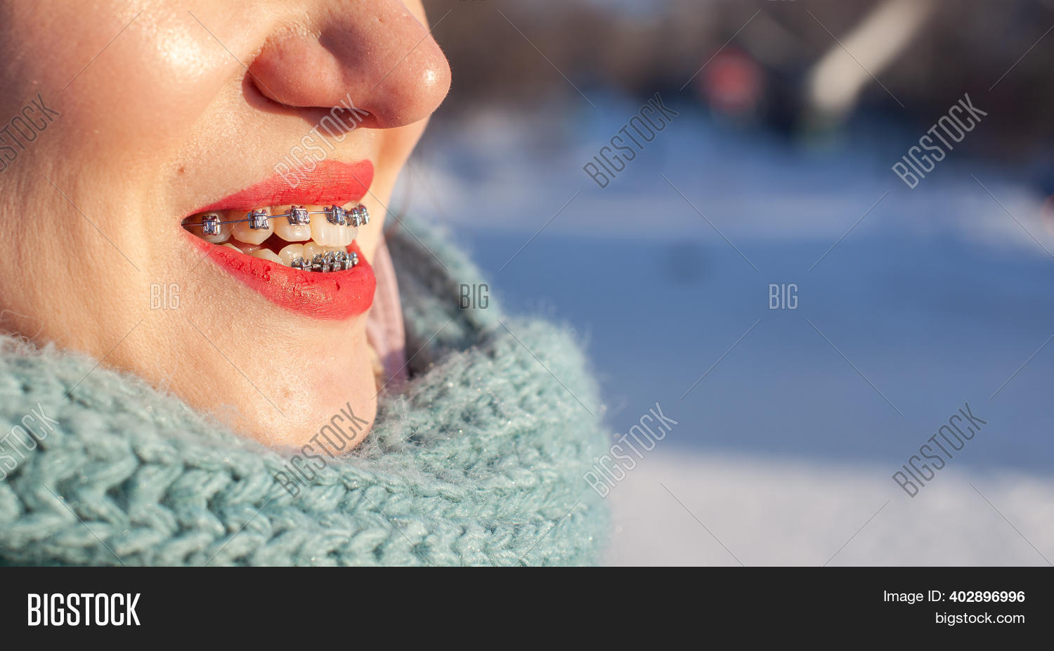 Girl Has Braces On Her Image & Photo (Free Trial) | Bigstock