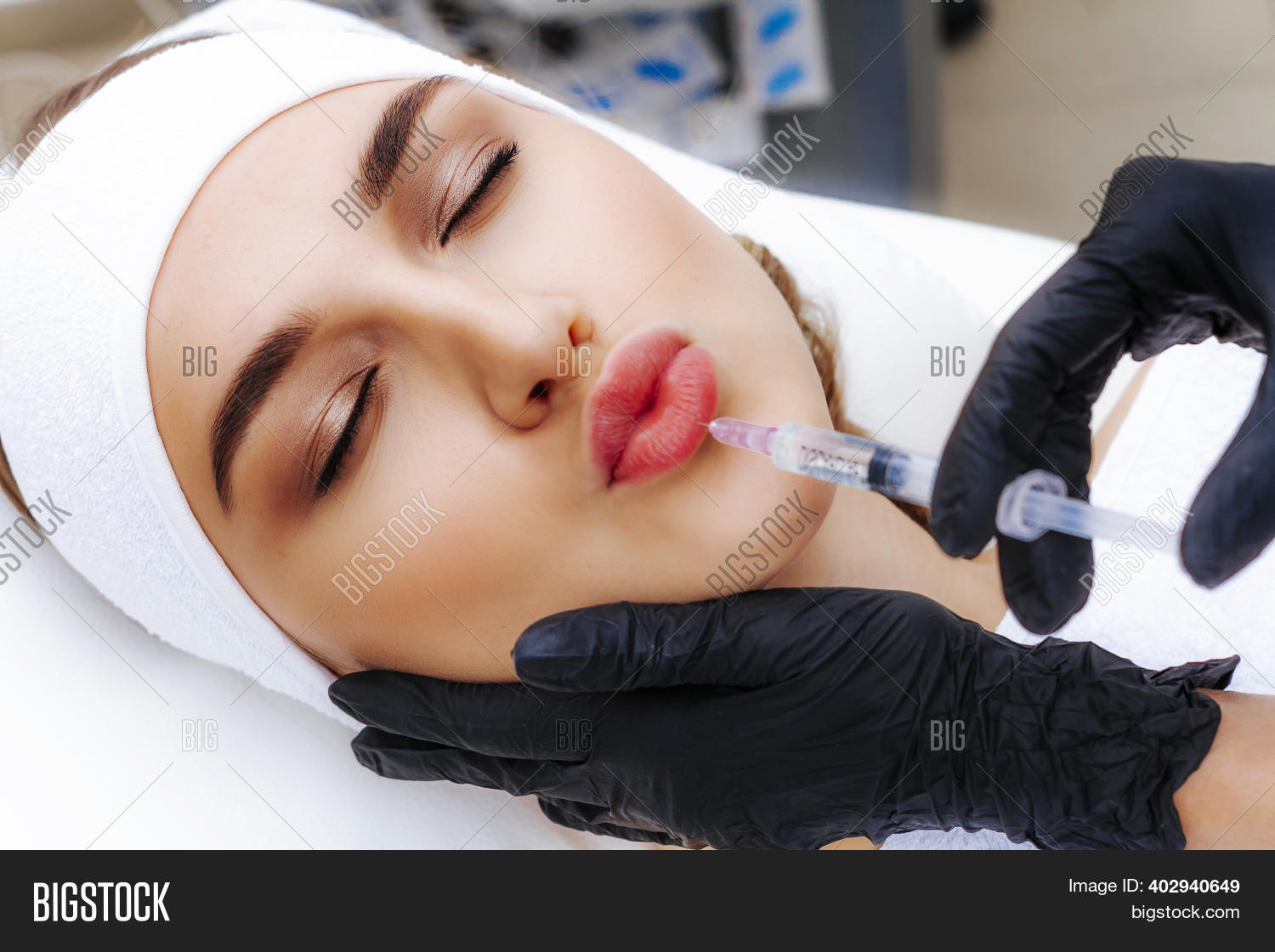 Lip Augmentation Image & Photo (Free Trial) | Bigstock