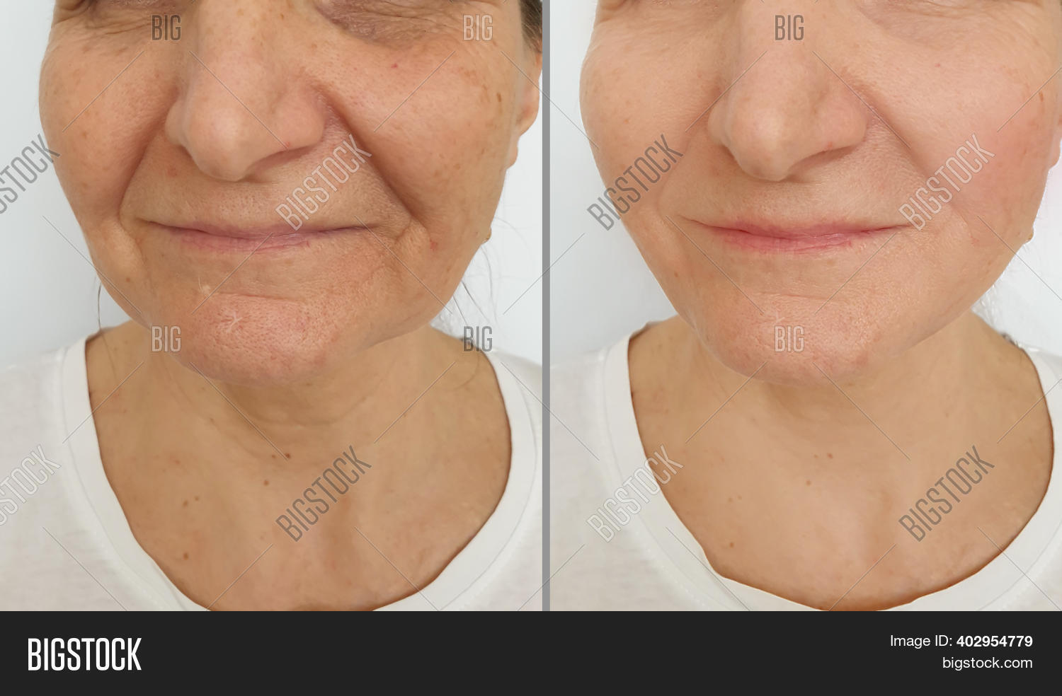 Woman Face Wrinkles Image & Photo (Free Trial) | Bigstock