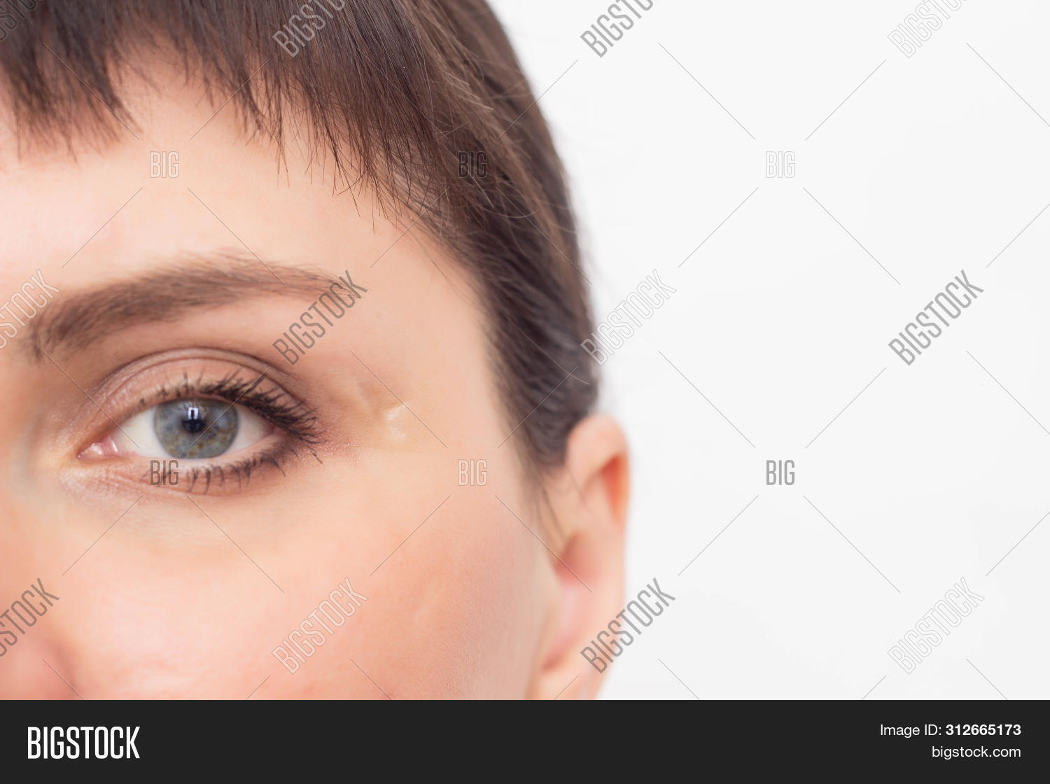 Imagen y foto Beautiful Girl Scar (prueba gratis) | Bigstock