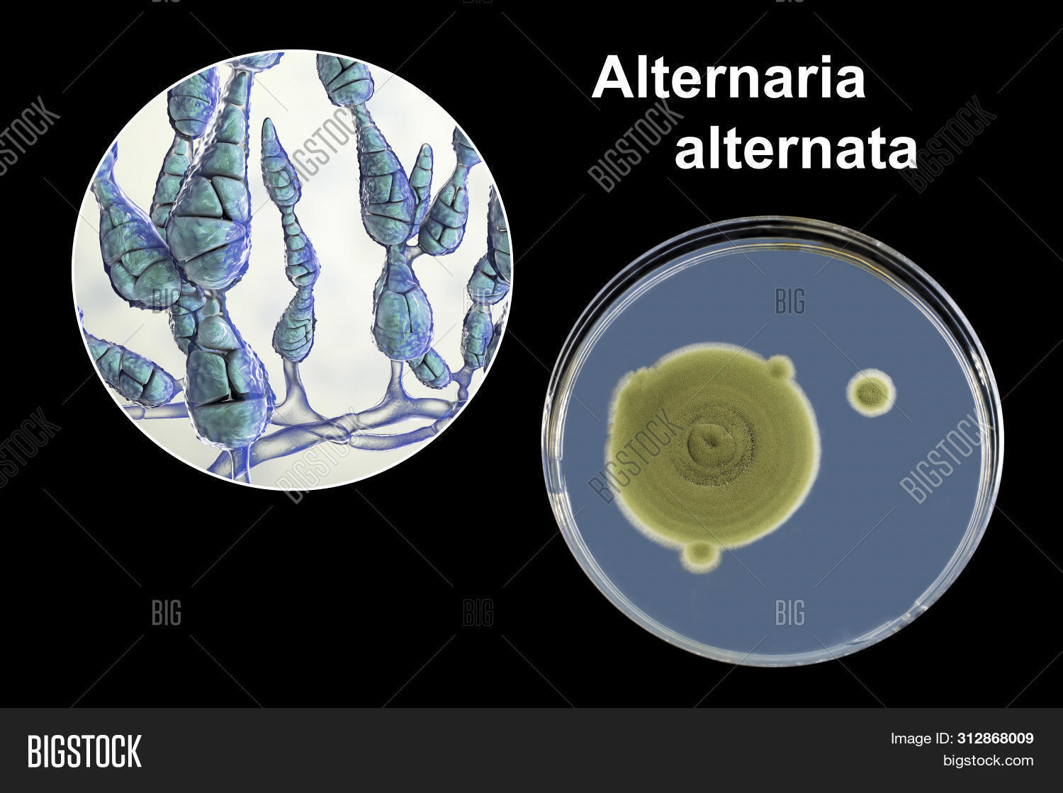 Imagen y foto Mold Alternaria (prueba gratis) | Bigstock