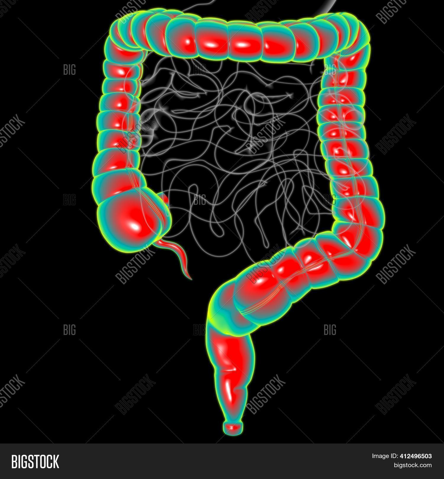 Large Intestine 3D Image & Photo (Free Trial) | Bigstock