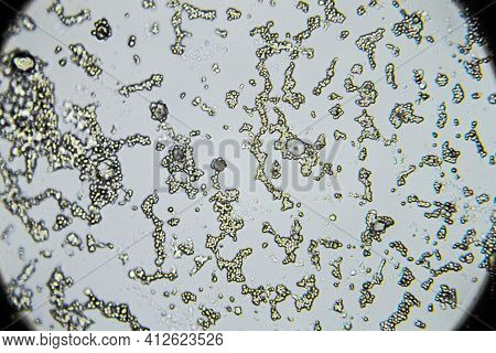 Mold Spores Under Image & Photo (Free Trial) | Bigstock