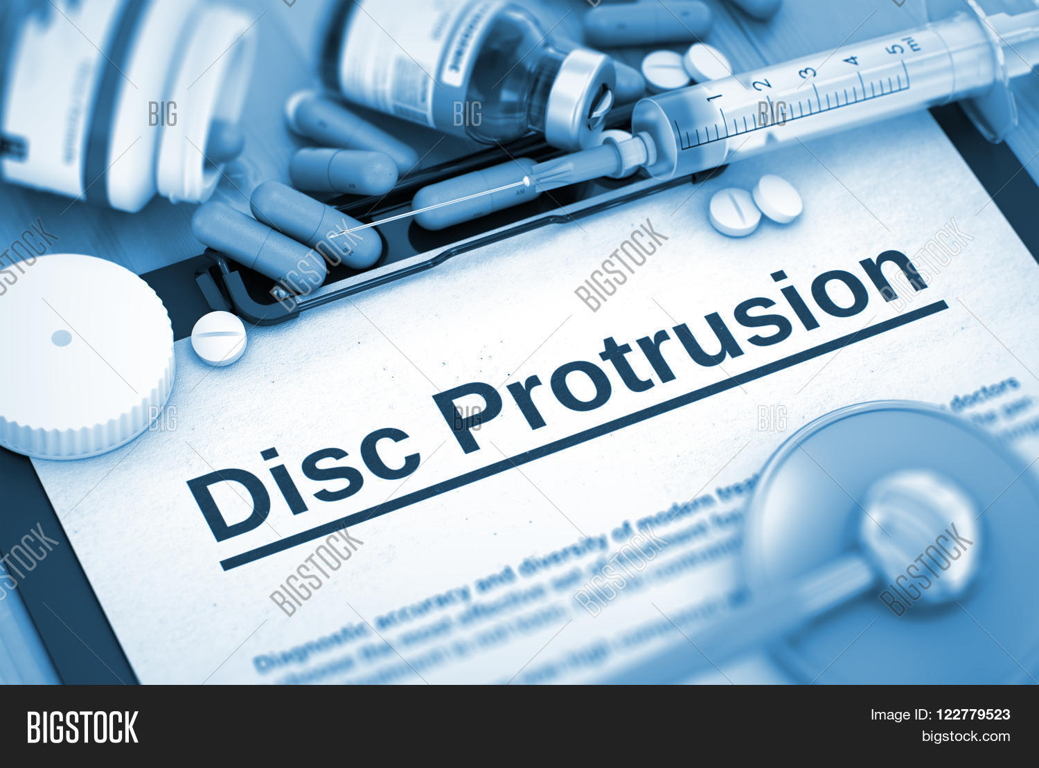 Disc Protrusion - Image & Photo (Free Trial) | Bigstock