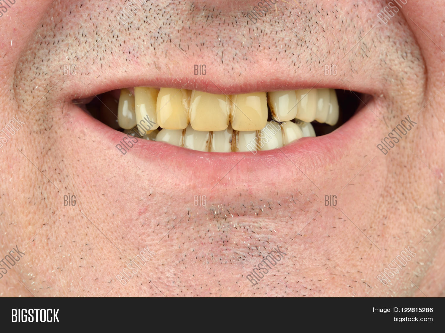 Detailed Image Man Image & Photo (Free Trial) | Bigstock