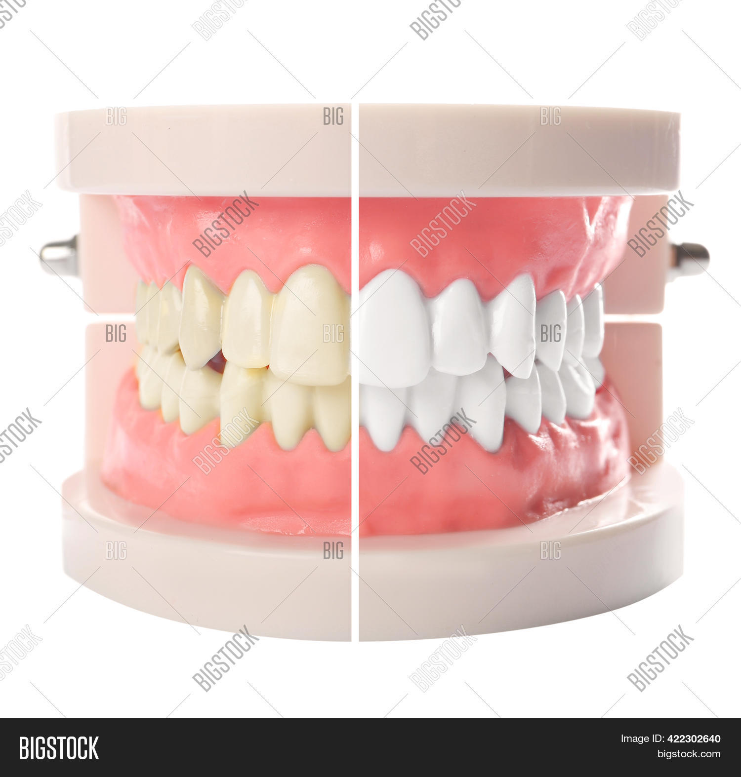 Model Oral Cavity Image & Photo (Free Trial) | Bigstock