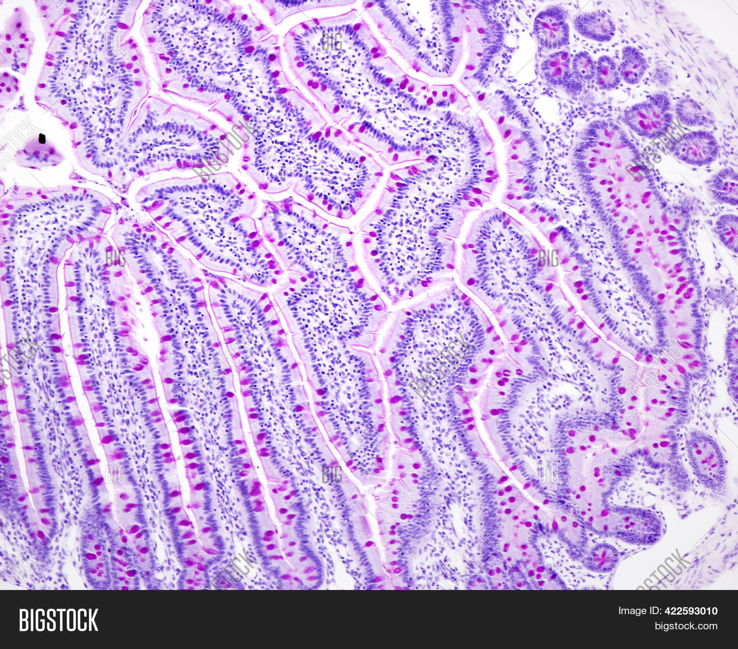Light Micrograph Image & Photo (Free Trial) | Bigstock