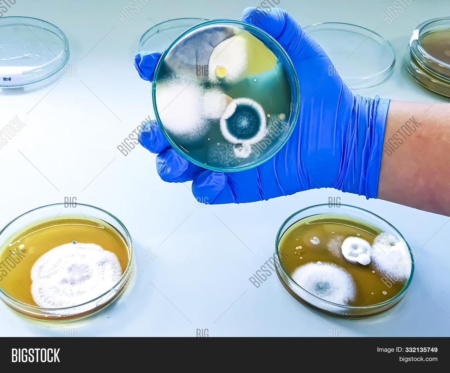 Malt Extract Agar Image & Photo (Free Trial) | Bigstock