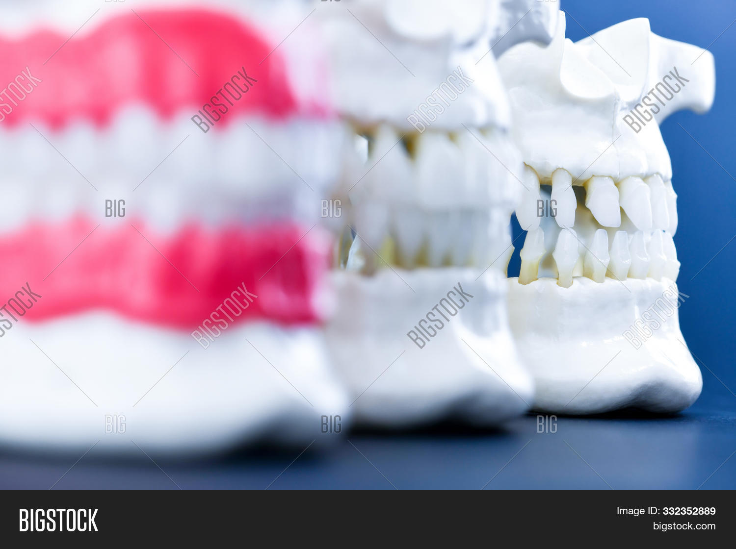 Human Jaws Teeth Gums Image & Photo (Free Trial) | Bigstock