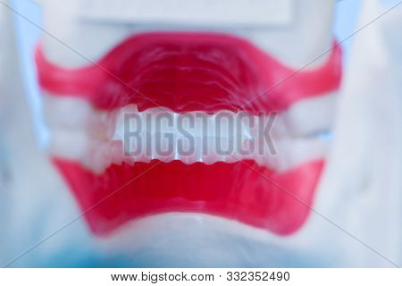 Inside View Human Jaw Image & Photo (Free Trial) | Bigstock