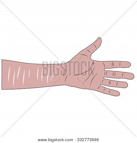 Man Hand Scars On Vector & Photo (Free Trial) | Bigstock