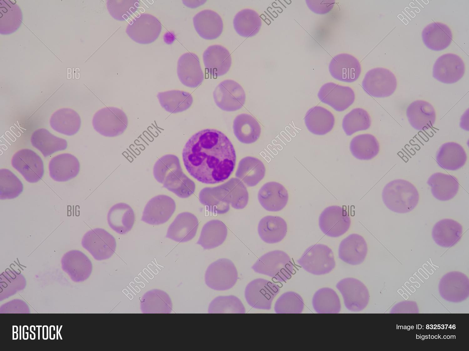 Red Blood Cells Form Image & Photo (Free Trial) | Bigstock
