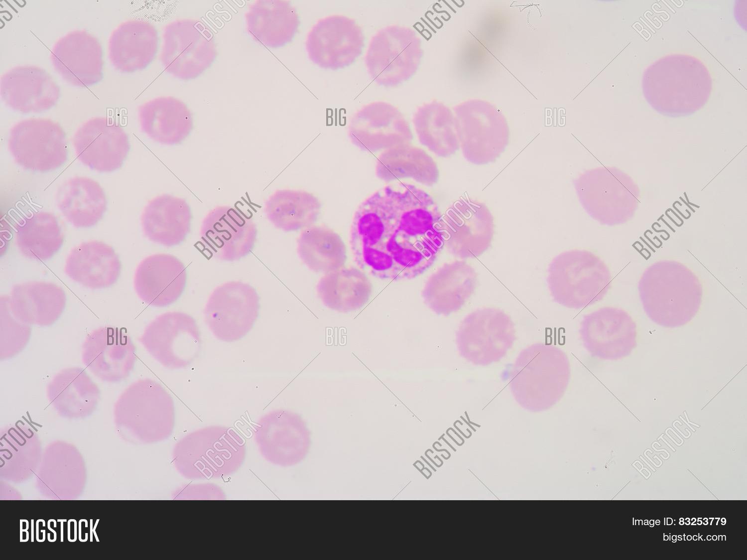 Cytoplasmic Image & Photo (Free Trial) | Bigstock