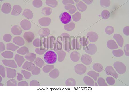 Red Blood Cells Form Image & Photo (Free Trial) | Bigstock