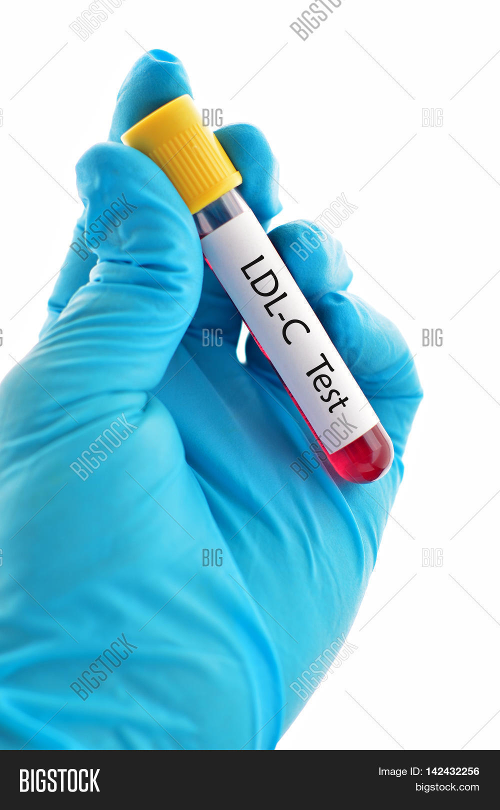 Test Tube Blood Sample Image & Photo (Free Trial) | Bigstock