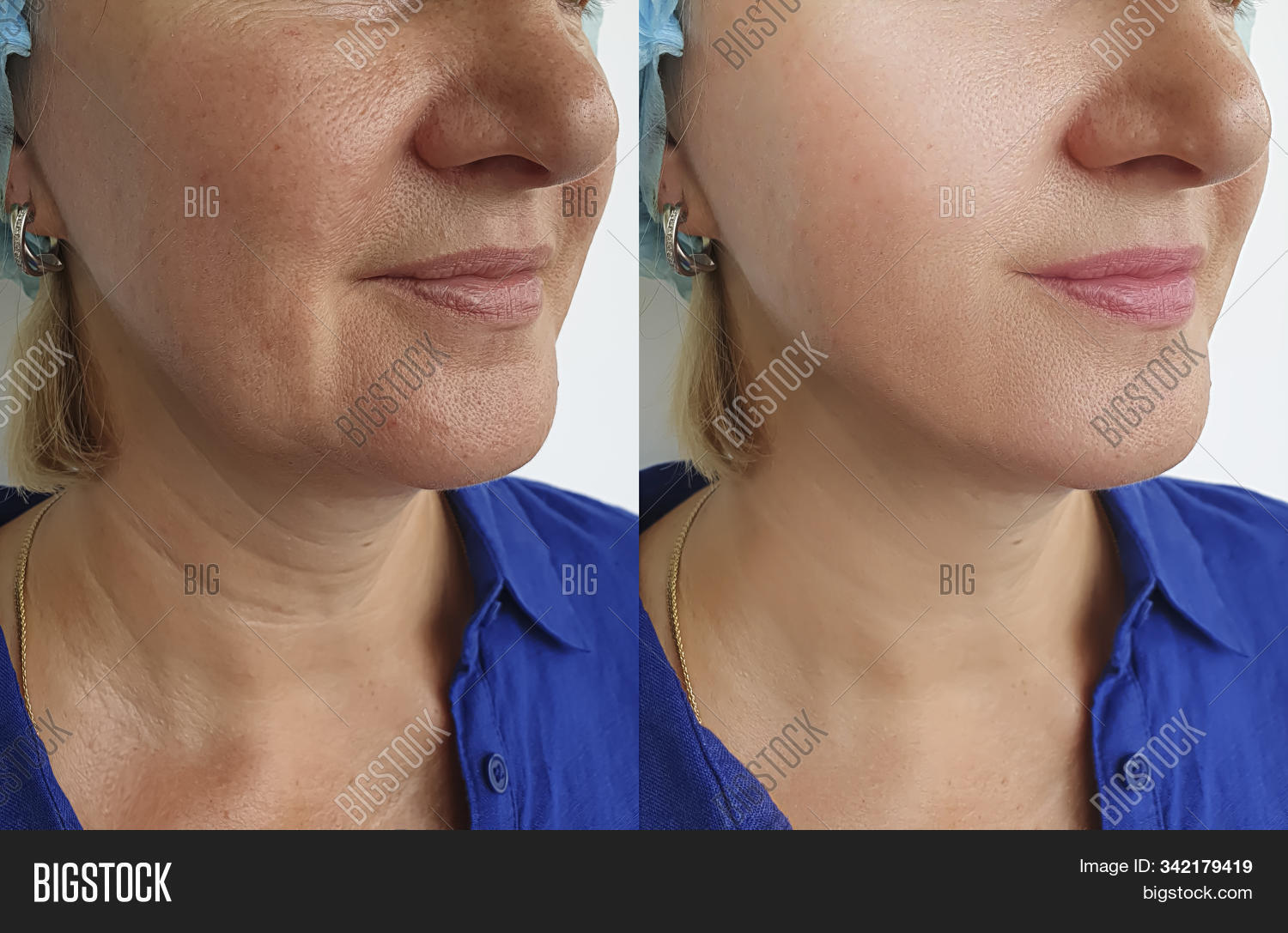Woman Wrinkles Face Image & Photo (Free Trial) | Bigstock