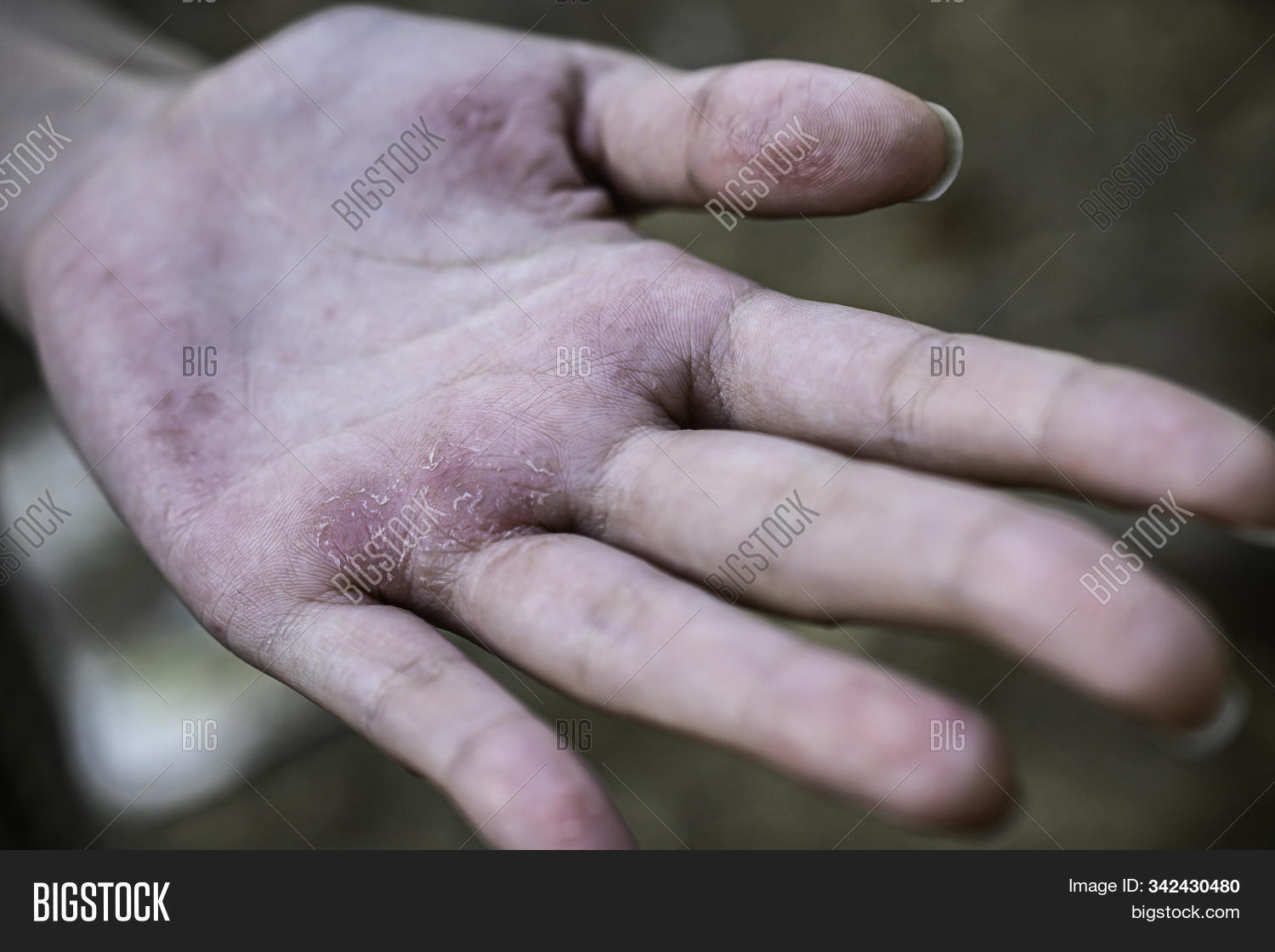 Skin Healthy Care. Image & Photo (Free Trial) | Bigstock
