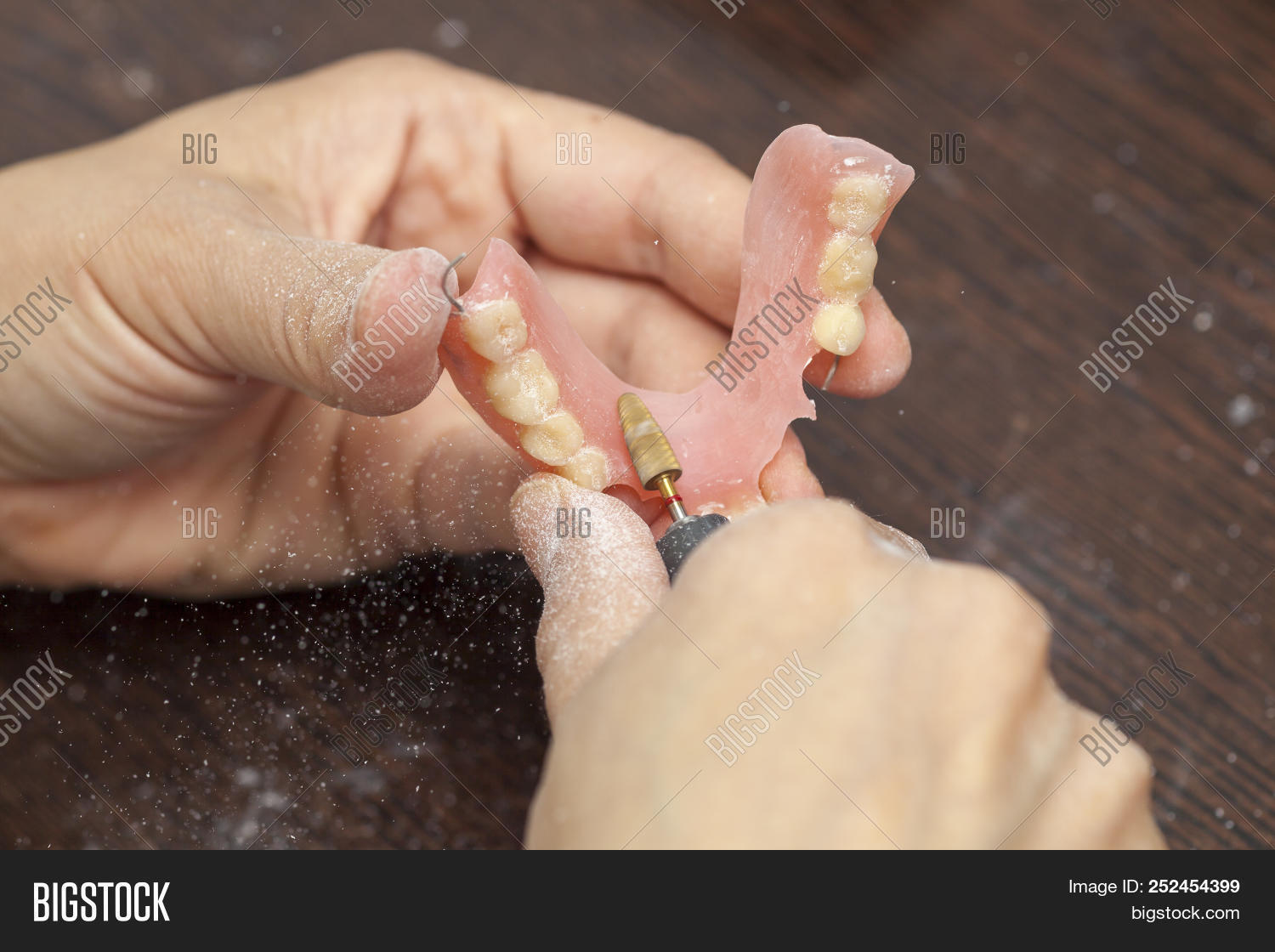 Hands Dental Image & Photo (Free Trial) | Bigstock