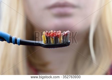 Toothbrush Blood Image & Photo (Free Trial) | Bigstock