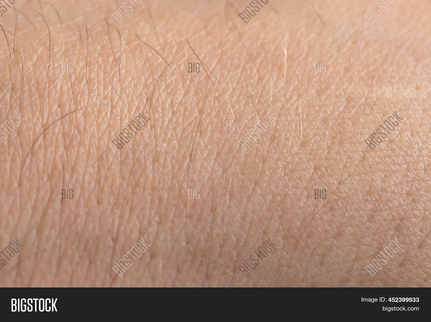 Macro Human Skin Hair Image & Photo (Free Trial) | Bigstock