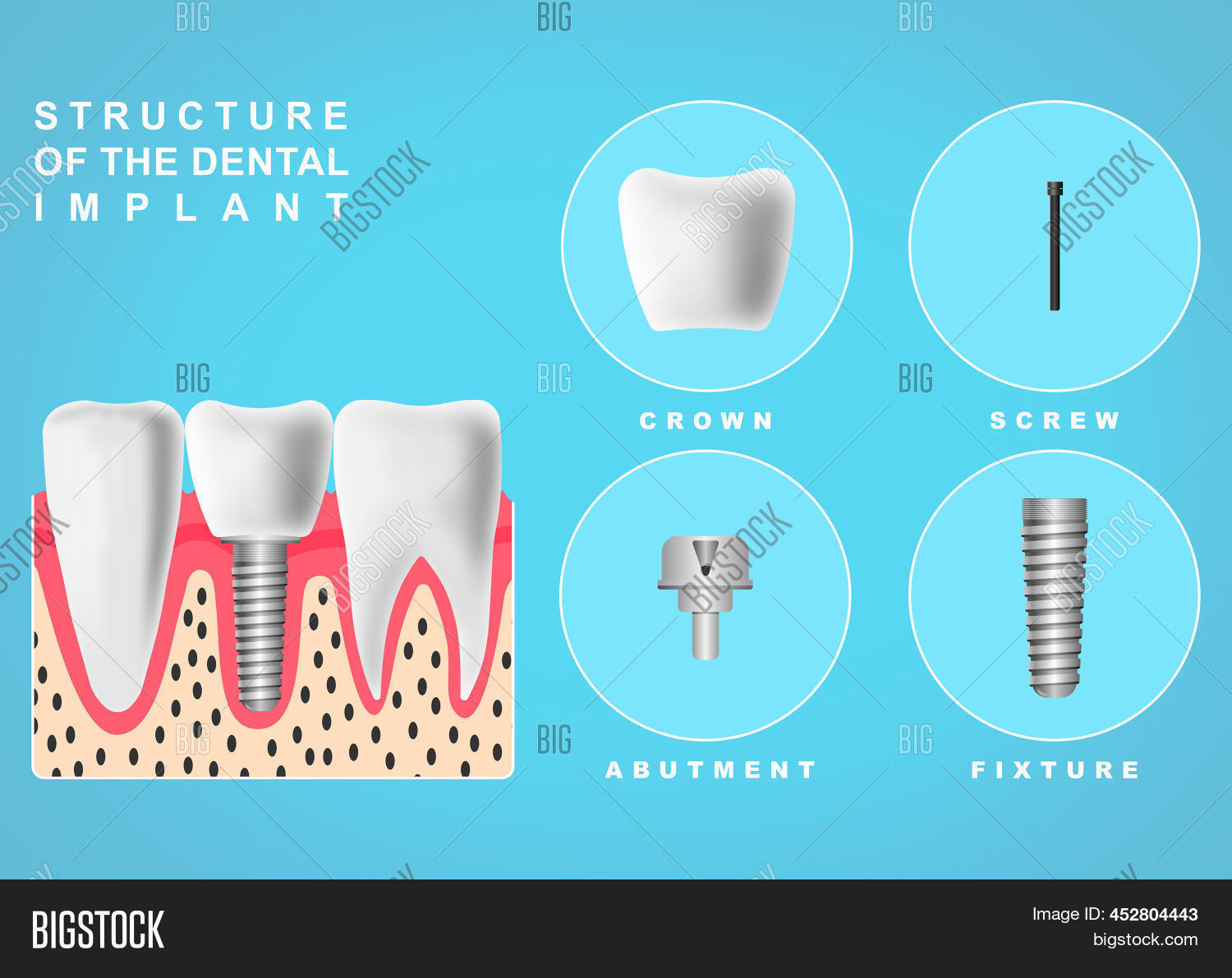 Structure Dental Image & Photo (Free Trial) | Bigstock