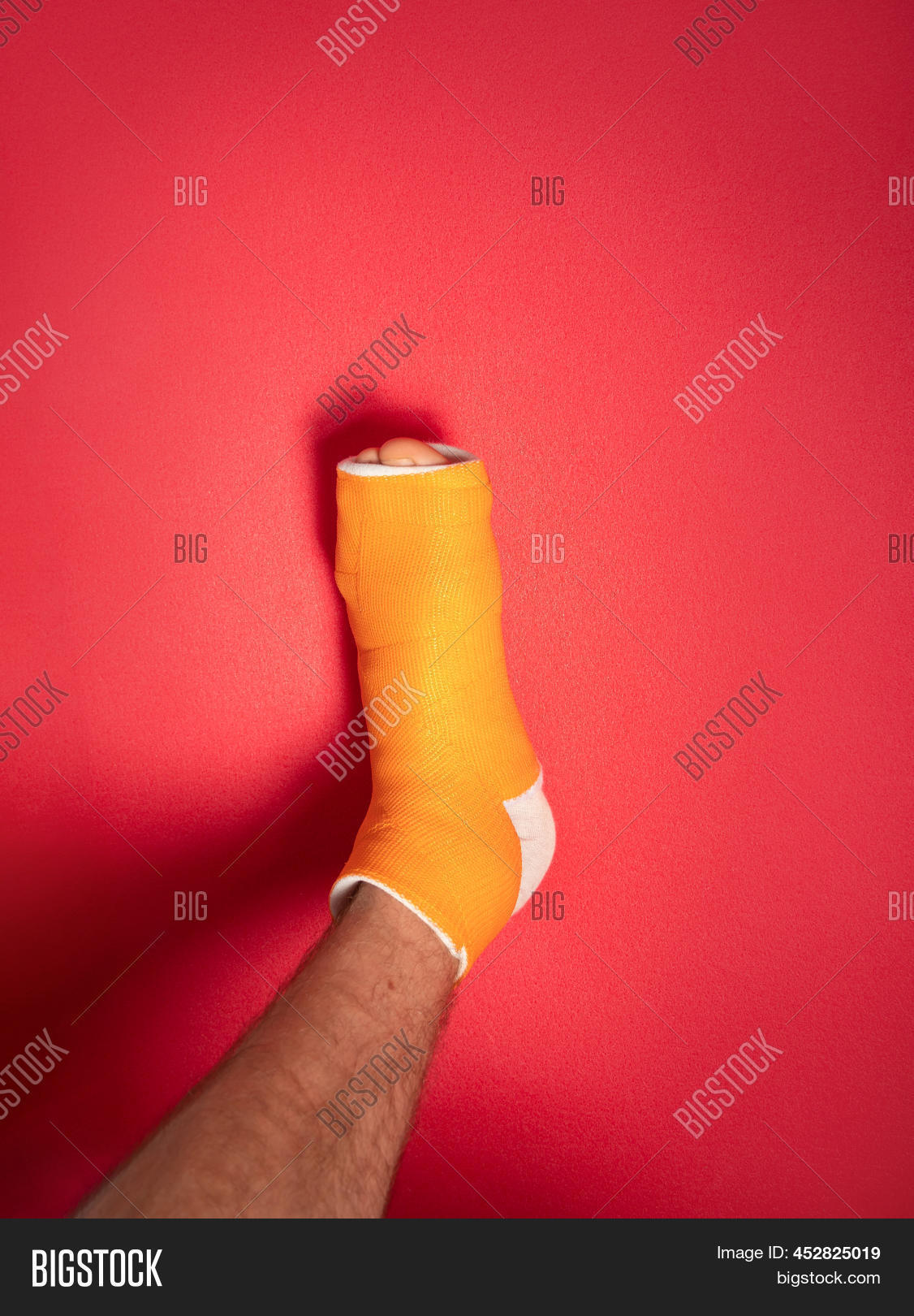 Foot Broken Toe Bone Image & Photo (Free Trial) | Bigstock