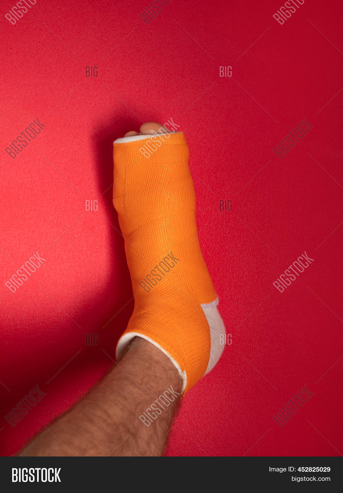 Foot Broken Toe Bone Image & Photo (Free Trial) | Bigstock