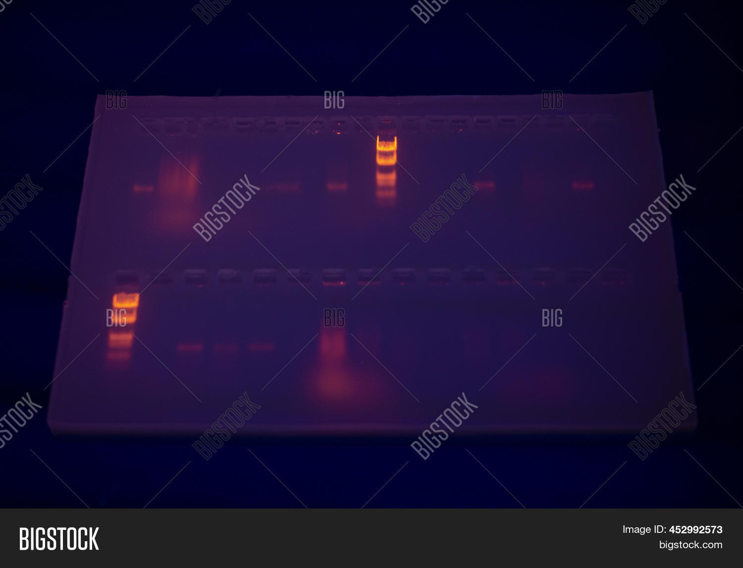 Luminous Dna Bands Image & Photo (Free Trial) | Bigstock
