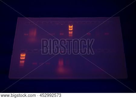 Luminous Dna Bands Image & Photo (Free Trial) | Bigstock