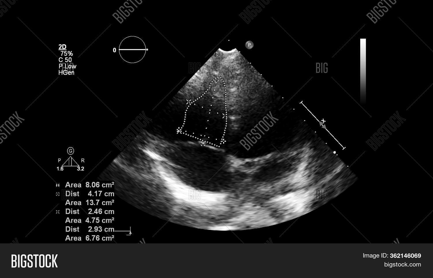 Image Heart Gray-scale Image & Photo (Free Trial) | Bigstock