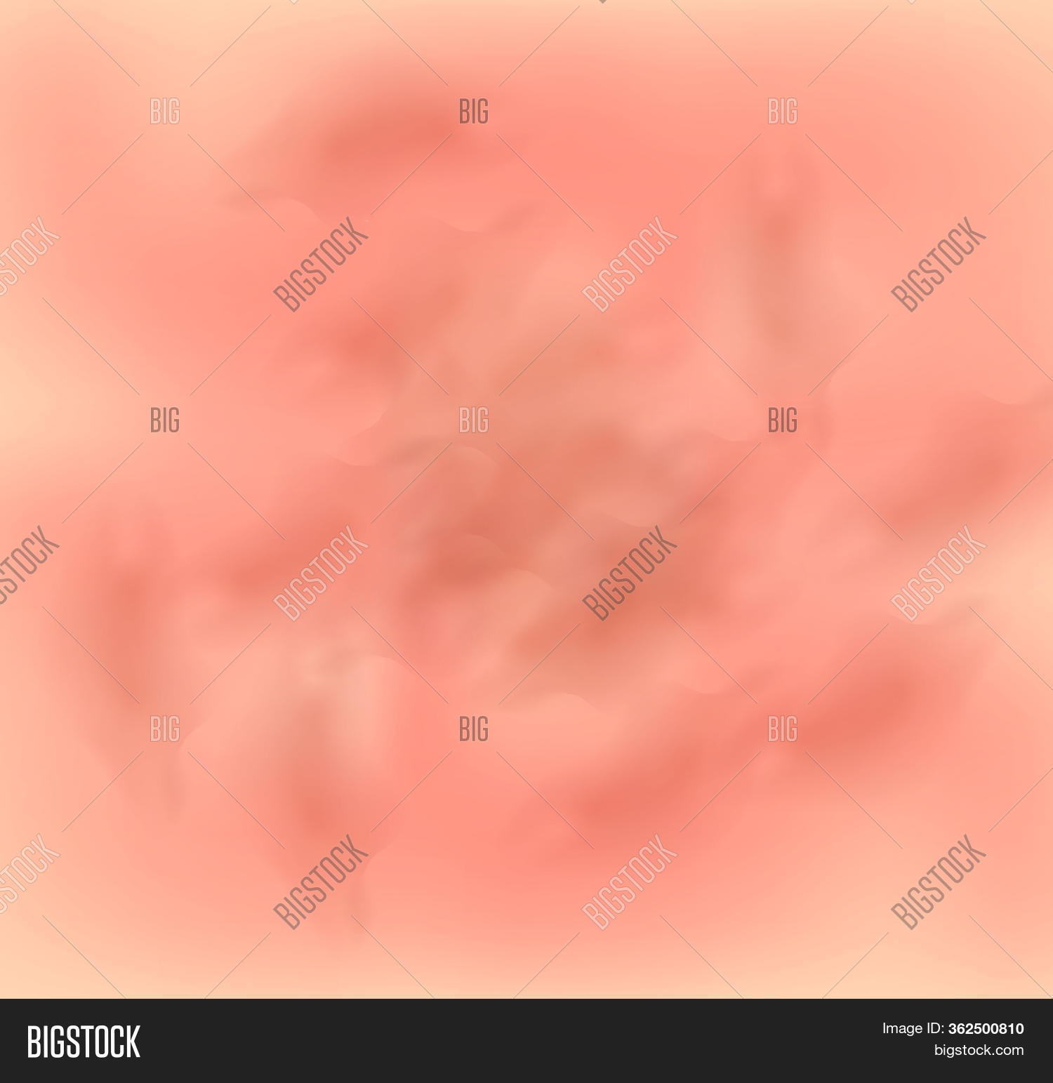 Skin Inflammation. Image & Photo (Free Trial) | Bigstock