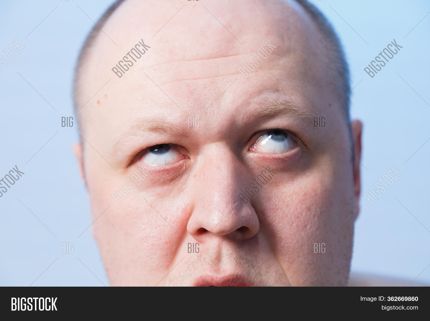Portrait Bald Man Who Image & Photo (Free Trial) | Bigstock